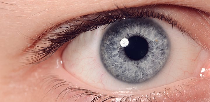 Queratitis infecciosa: Síntomas y tratamiento